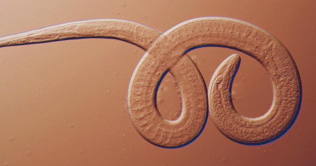 Family members infected with brain worms after eating undercooked bear ...